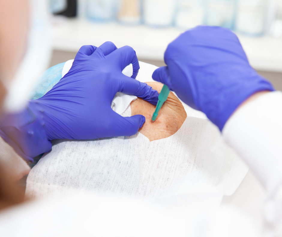 Biopsie sein : Ce qu’il faut savoir avant l’examen