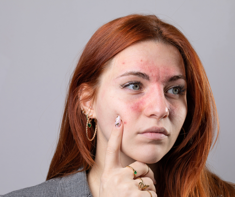 Eczéma visage : découvrez les causes et agissez maintenant